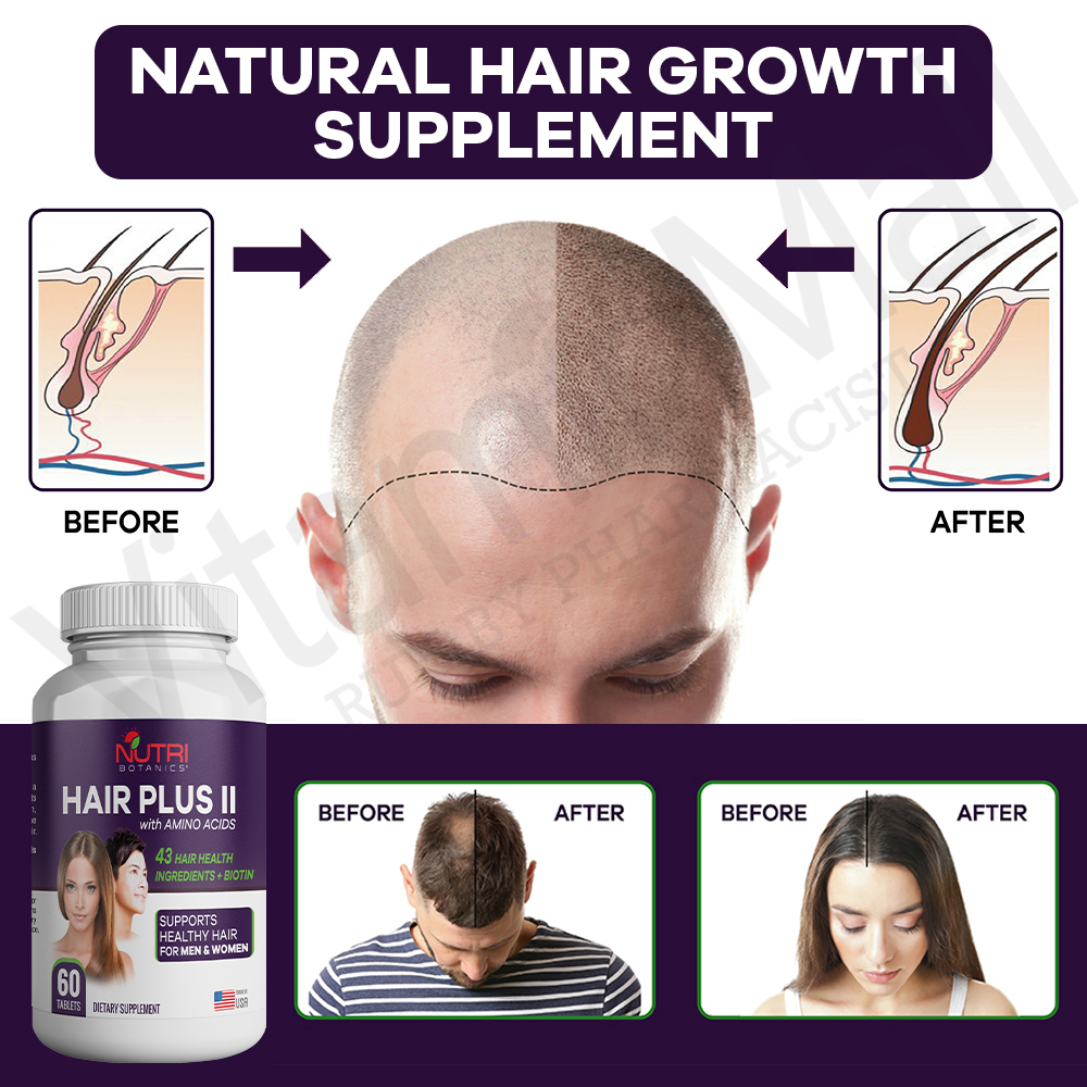 Hair Plus II with Amino Acids - Hair Growth Supplement, Stop Hair Loss ...